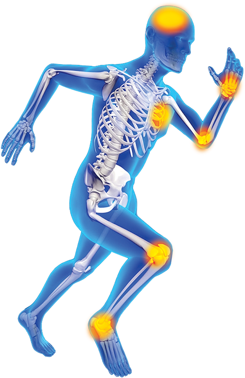 Download Joint Pain Skeleton - Skeleton Pain - HD Transparent PNG ...