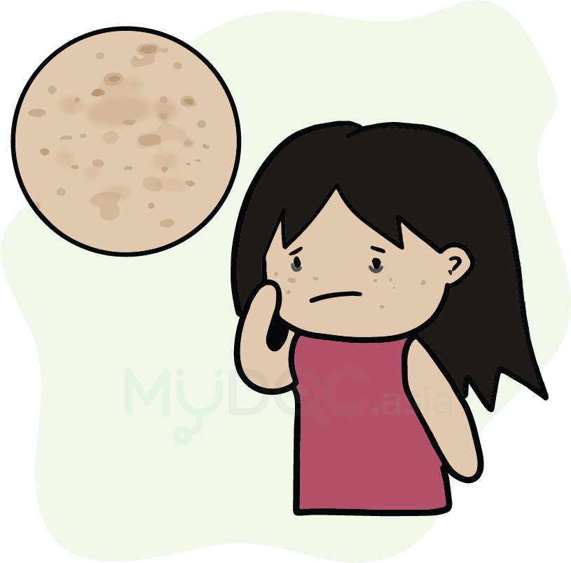 Download Eye Patch Clipart Translucent - Cartoon - HD Transparent PNG ...